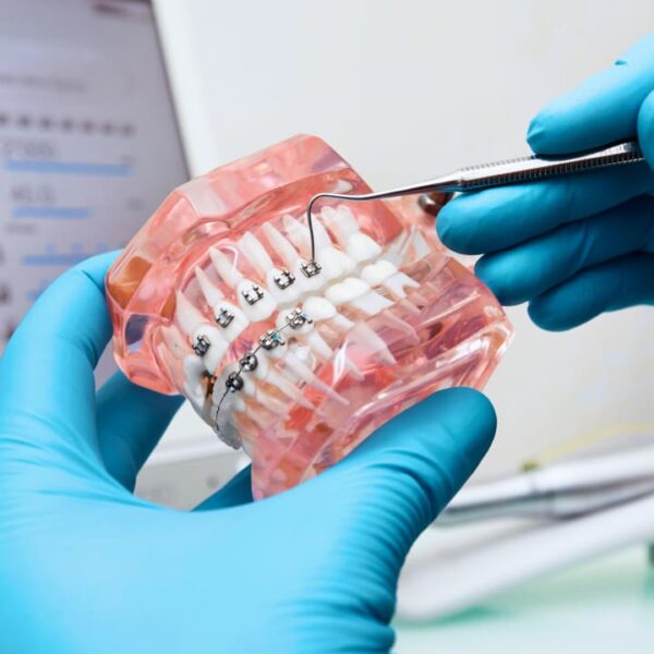 Portfolio Archive – Dentist & Orthodontist Serving Silver Spring ...