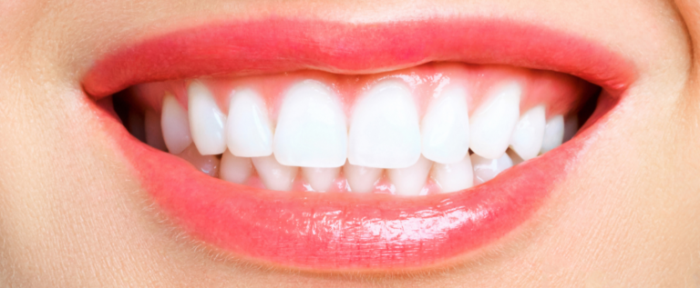 Before & After – Dentist & Orthodontist Serving Silver Spring ...
